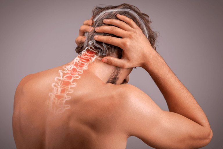 Occipital Neuralgia Pain Management in MD | Synergy Spine & Pain Center